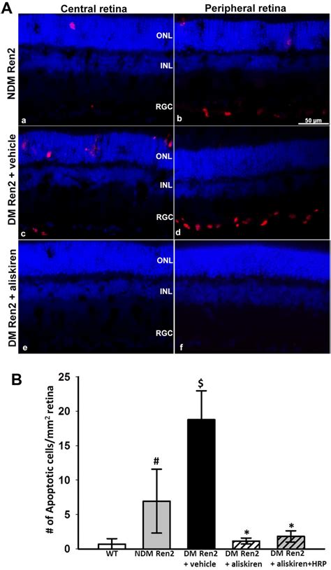 In Situ Cell Death Detection In The Retina A Apoptotic Cells Were