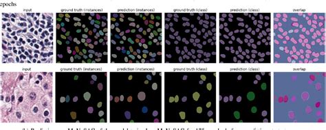 Figure 2 From Combining Datasets With Different Label Sets For Improved Nucleus Segmentation And