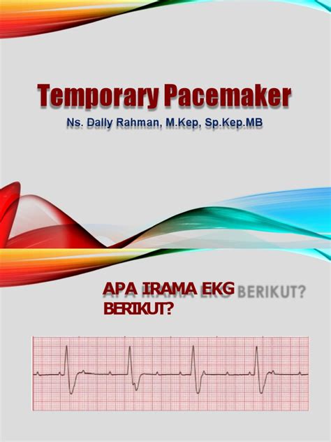 Temporary Pacemaker Pdf