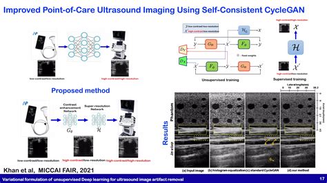 Variational Formulation Of Unsupervised Deep Learning For Ultrasound Image Artifact Removal