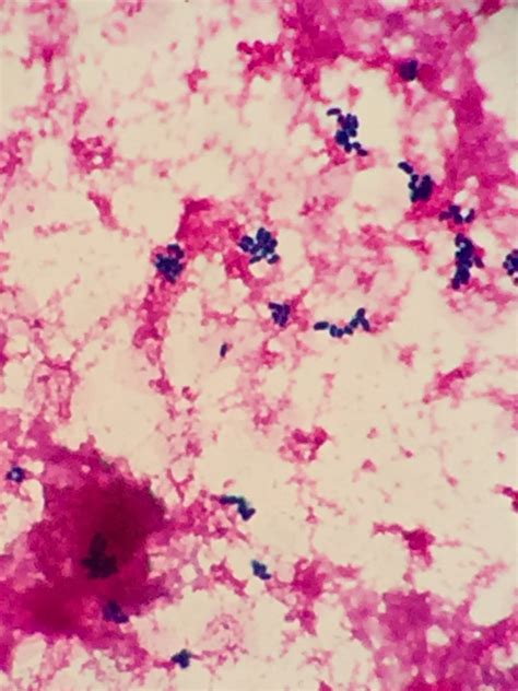 血液培養でGPCがみえたら グラム染色 Gram Stain