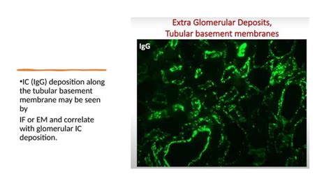 Histopathology Of Classes Of Lupus Nephritis Pptx