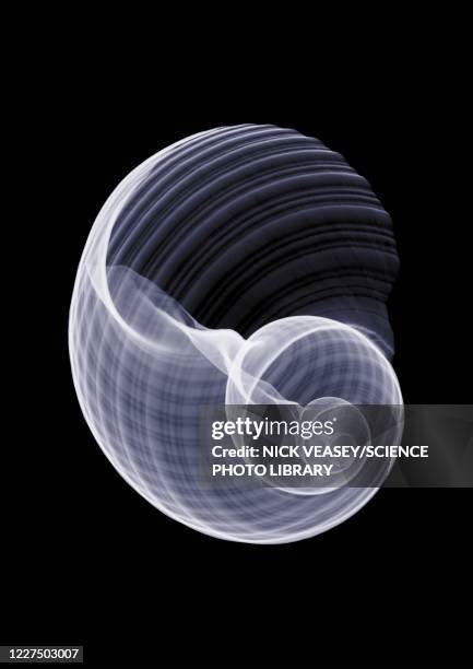 X Ray Print Photos And Premium High Res Pictures Getty Images