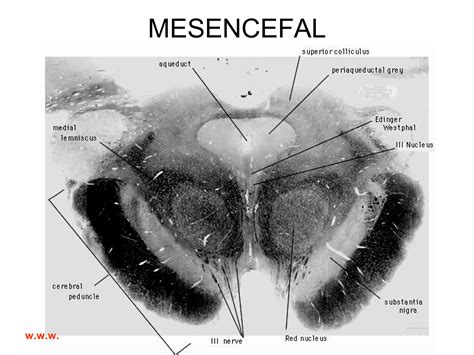 Atlas De Neuroanatomie Trunchiul Cerebral Ppt
