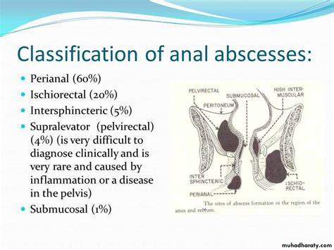 Perirectal Abscess Statpearls Ncbi Bookshelf