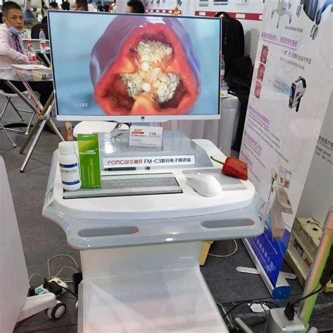 Low Cost High Definition Biopsy Colposcopy Cervical Hpv Exam Colposcope