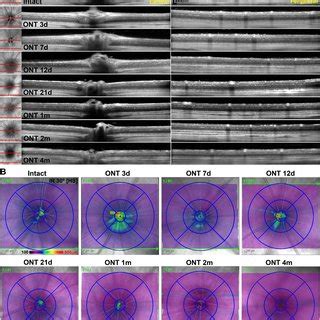Representative Images From The In Vivo OCT Volume Scan Analysis A In Download Scientific