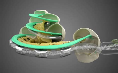 9 Reasons Why Cochlear Implant Electrodes Matter Med El Professionals Blog