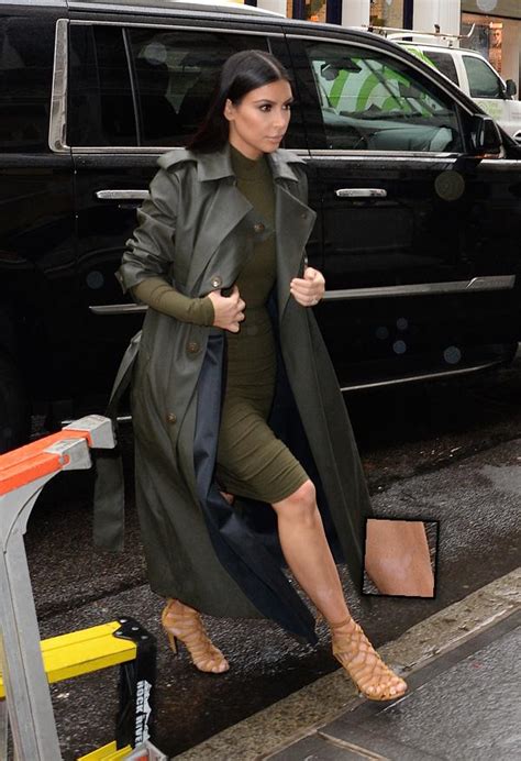 A Rough Patch Kim Kardashian Suffers Skin Disease Psoriasis Again During Marriage Crisis