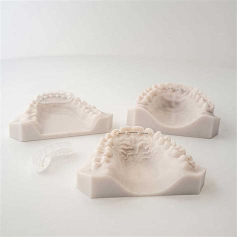 Fixed Lingual Retainers Odl Orthodontic Labs