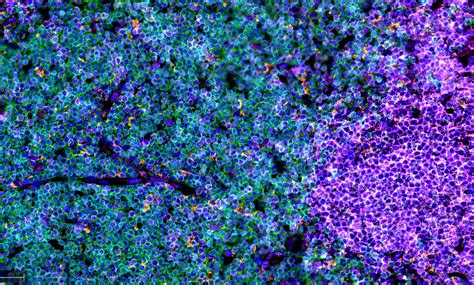4 Plex Immunofluorescence Staining Dapi Four Marker Detection Ihisto