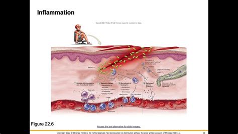 Innate Immune System Interferons Complement System Inflammation