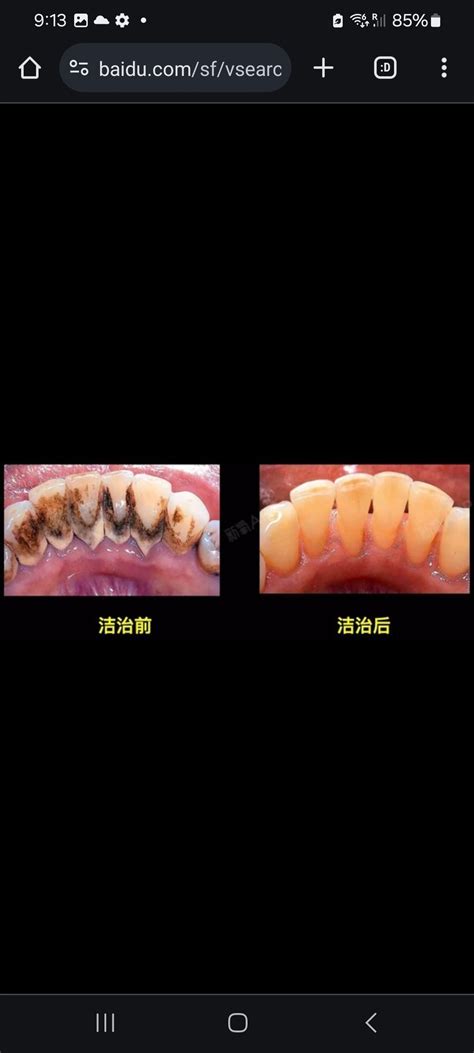 Teeth Object Object Detection Dataset By Testing