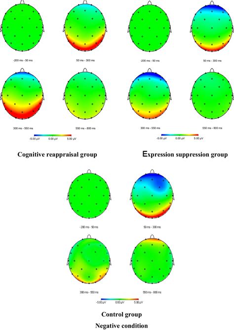 Brain Topographic Maps During The Processing Of Emotional Pictures By