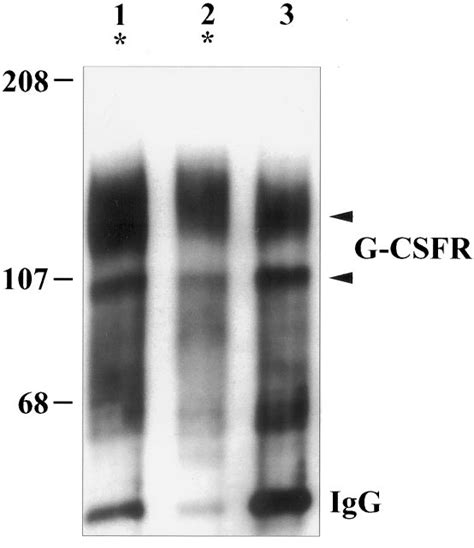Detection Of The G Csfr Protein In Western Blot Analyses 1 Ì 10 7 Download Scientific Diagram