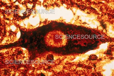 Motor Neuron Structure Stock Image Science Source Images