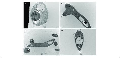 Representative Tem Micrographs Of Pyricularia Oryzae Untreated