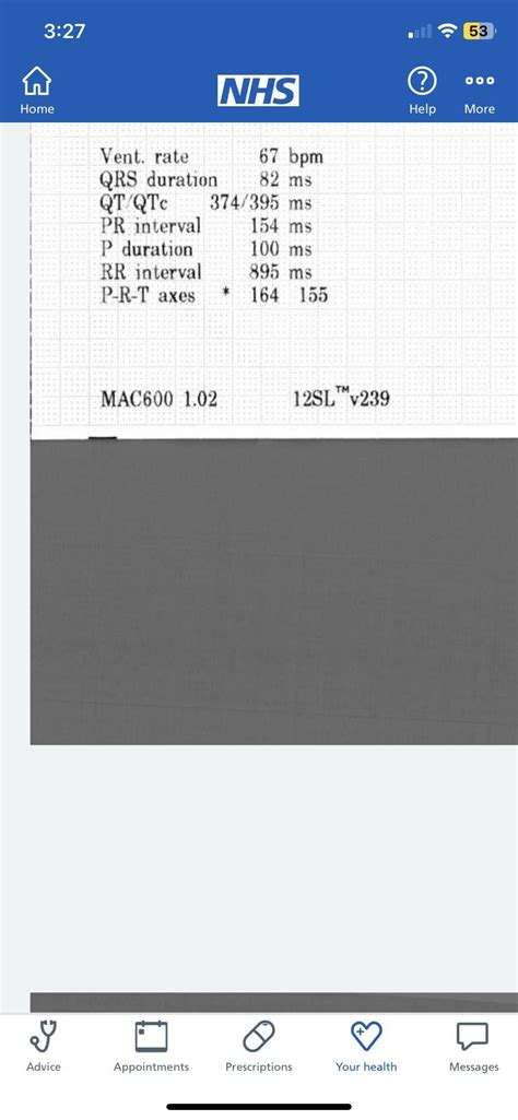 Ecg Notes Say Abnormal And Right Axis Deviation R Readmyecg