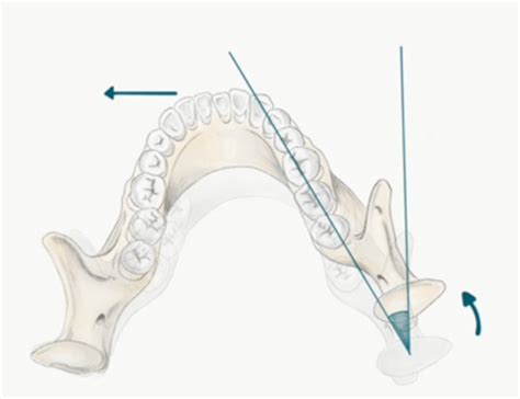 Occlusion Flashcards Quizlet