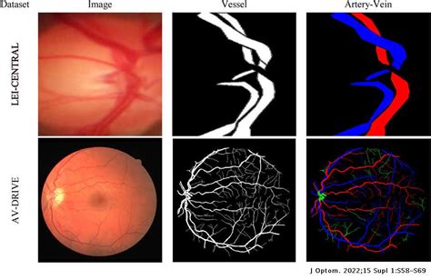 Msganet Rav A Multiscale Guided Attention Network For Artery Vein Segmentation And