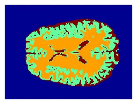 Clustering Results Using Four Algorithms A Original Image B