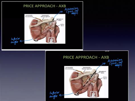 Shoulder Block Tutorial 2014 Ppt Free Download