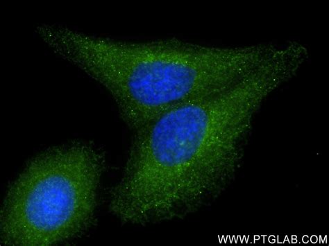 Bst2 Antibody 82733 7 Rr Proteintech