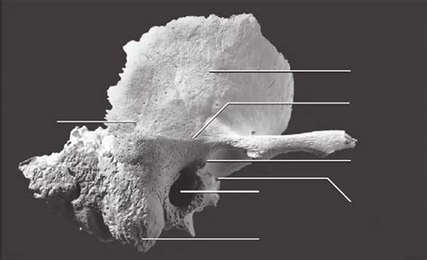 Temporal Lateral Diagram Quizlet