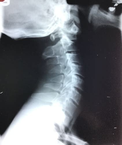 Skele C Lab Midterm Content Flashcards Quizlet