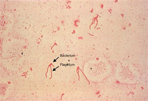 Yersinia Enterocoliticastain Safety Pin Appearance