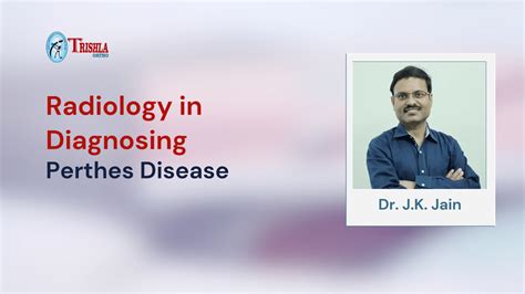 Radiology In Diagnosing Perthes Disease Trishlaortho