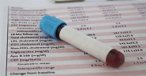 Hdl Kolesterol Nedir Hdl Kolesterol Düşüklüğü Ve Yüksekliği Neden Olur Belirtileri Neler