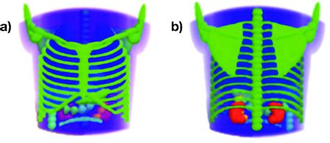 Mathematical Model Of Torso Mmt For Numerical Simulations Of