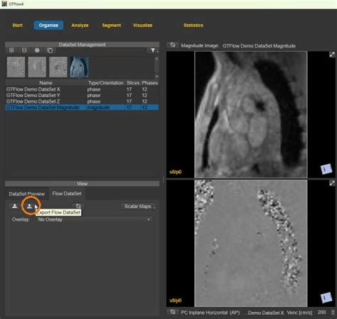 4 Common Workflows — Gtflow 48x Documentation
