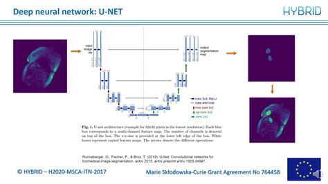 Hybrid Ai Tutorials Deep Learning Based Automatic Segmentation On