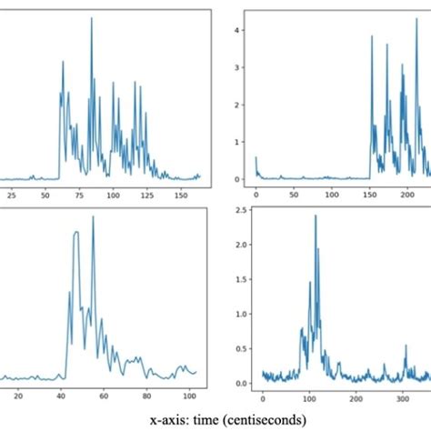 Normal And Anomalous Train Of Four Tof Patterns Upper Figures Download Scientific Diagram