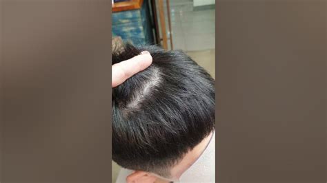 군 전역 이후 받으시는 남자 짧은 머리 악성곱슬 볼륨매직 Youtube