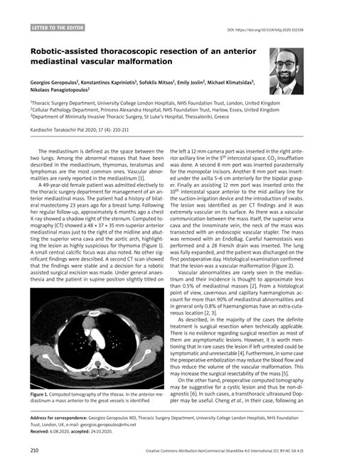 Pdf Robotic Assisted Thoracoscopic Resection Of An Anterior Mediastinal Vascular Malformation