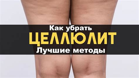 Как избавиться от Целлюлита на ногах 7 Лучших методов Youtube