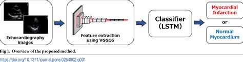 Figure 1 From Automated Detection Scheme For Acute Myocardial