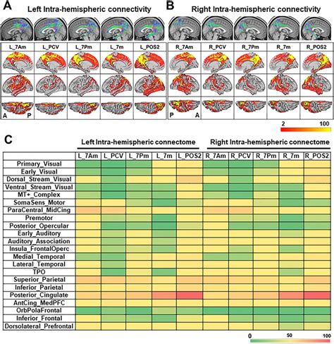 Intra Hemispheric Structural Connectivity Sc Of Precuneus A B Download Scientific Diagram