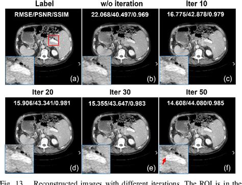 Figure 13 From Iterative Residual Optimization Network For Limited Angle Tomographic