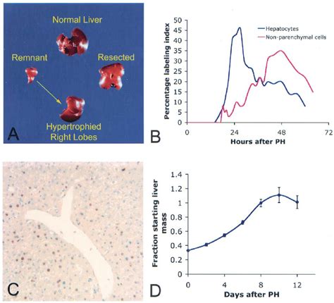 Liver Regeneration After Two Thirds Surgical Partial Hepatectomy Ph