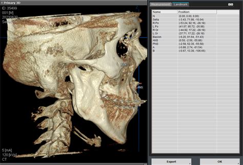 Parse Landmarks From DICOM File Issue 1879 Pydicom Pydicom GitHub