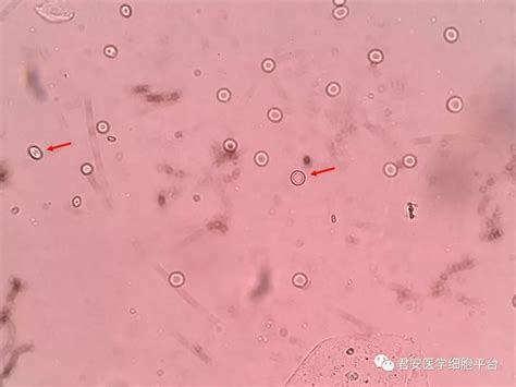 草酸钙结晶530 草酸钙结晶82 草酸钙结晶283 第9页 大山谷图库
