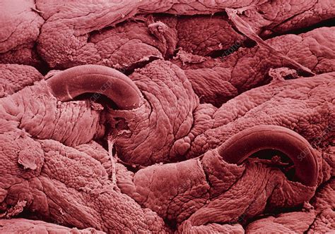 False Col Sem Of Trichostrongylus Vitrinus Stock Image Z180 0044 Science Photo Library