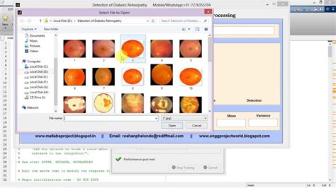 Diabetic Retinopathy Detection Using Neural Network Matlab Project Code