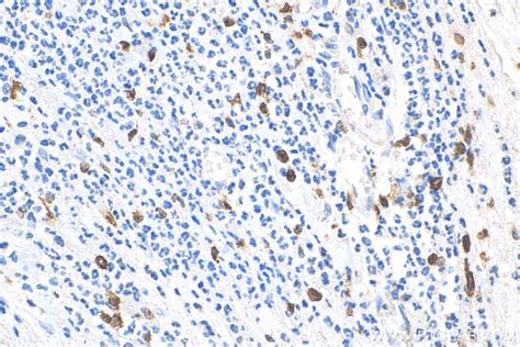 Cd163 Antibody 68218 1 Ig Proteintech