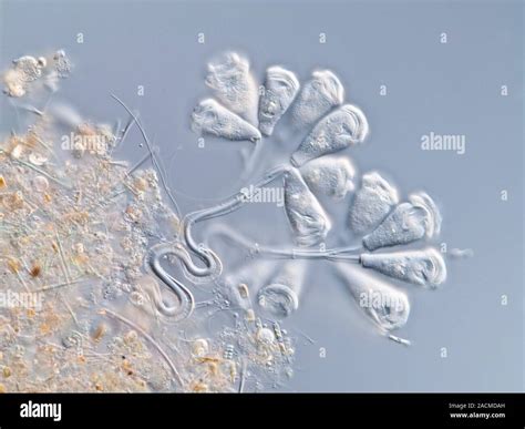 Peritrich Protozoa Differential Interference Contrast Micrograph Of A Colony Of Sessile Non