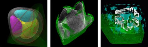 Figure 1 From Two Level Volume Rendering Fusing Mip And Dvr Semantic Scholar